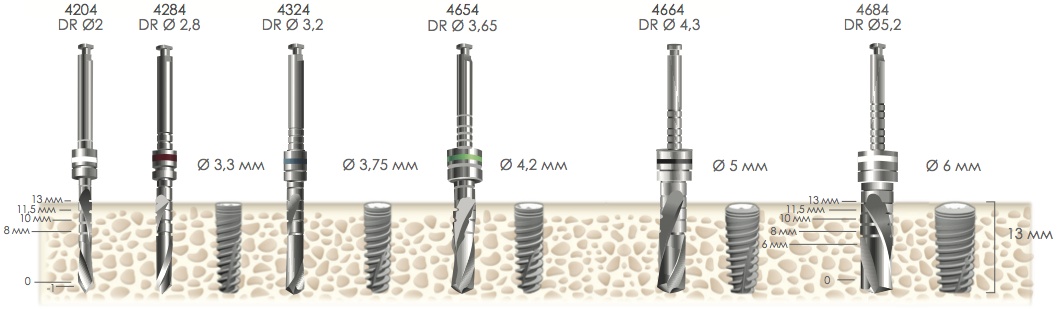 AlphaBio SPI | Подлинный спиральный имплантат