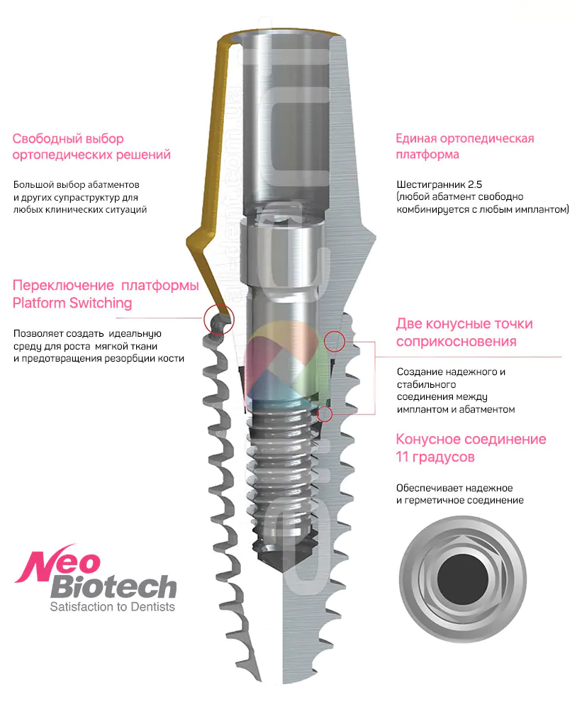 Имплантат NeoBiotech IS II Active | Neo CMI implant